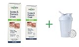 Wild Naturals Eczema & Psoriasis Cream Review [Updated Jan. 2019]