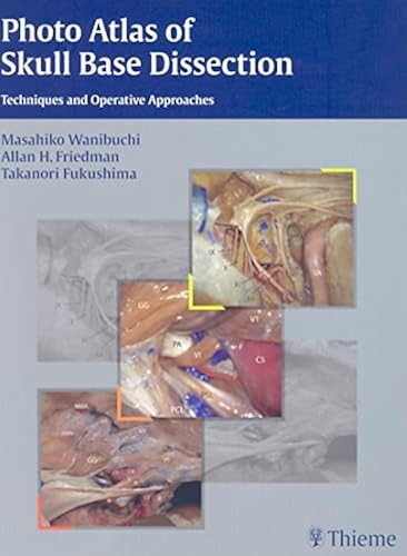 Photo Atlas of Skull Base Dissection: Techniques and Operative ...
