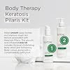 Glytone KP Kit for Keratosis Pilaris - Exfoliating Body Wash, Lotion ...