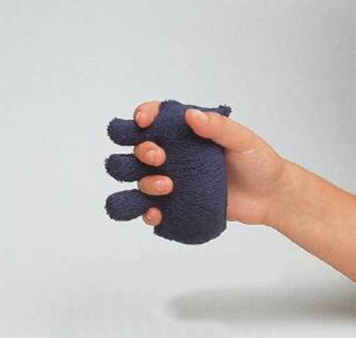 Compare price to cone splint | TragerLaw.biz