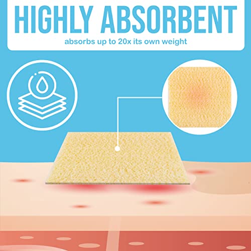 JJ CARE Honey Calcium Alginate Dressing 2”x 2” [Box of 10] Honey Wound ...