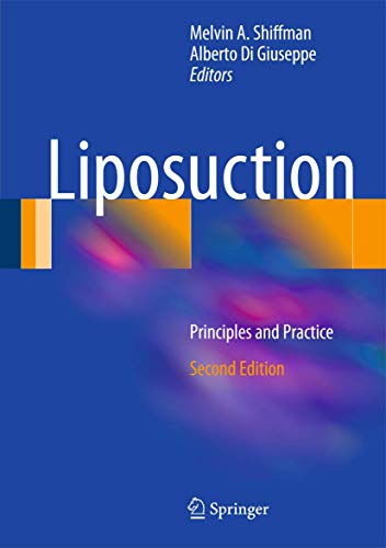 Liposuction: Principles and Practice: 0003662489015: Medicine & Health ...