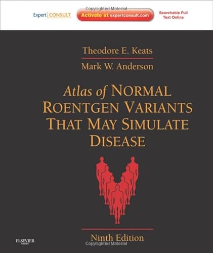 Atlas of Normal Roentgen Variants That May Simulate Disease in Saudi ...