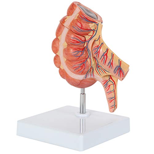Mua Axis Scientific Caecum and Appendix Anatomy Model | Large Intestine ...