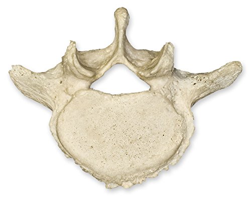 Real Human Vertebra Lumbar Natural Bone Quality A tillescenter ...