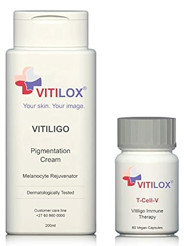 Vitiligo Vitilox® Pigmentation Cream and T-Cell-V Immune Therapy ...