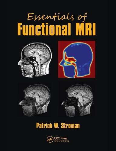 Essentials of Functional MRI: 9781439818787: Medicine & Health Science ...