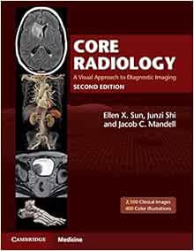 Core Radiology: A Visual Approach to Diagnostic Imaging: 9781108965910 ...
