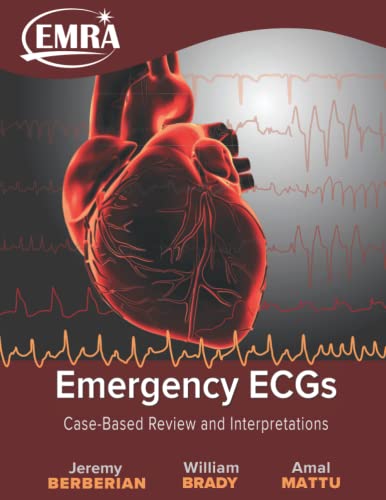 Emergency ECGs: Case-Based Review and Interpretations: Mattu, Amal ...