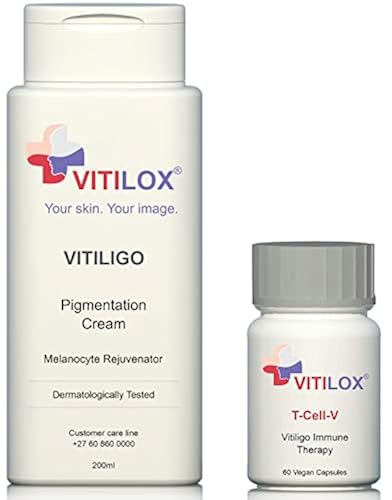 Vitiligo Vitilox® Pigmentation Cream and T-Cell-V Immune Therapy ...