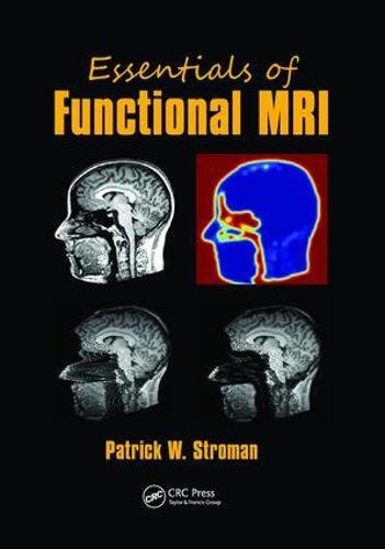 Essentials of Functional MRI: 9781138453791: Medicine & Health Science ...