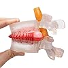 MIIRR Human Lumbar Disc Herniation Model, Transparent Medical Model of ...