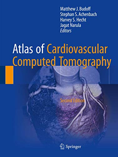 Atlas of Cardiovascular Computed Tomography: 9781447173564: Medicine ...