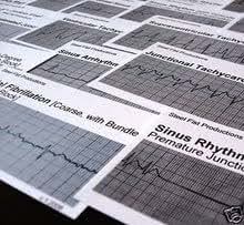 Amazon.com : EKG ECG Cardiac Acls Rhythm Strip Flashcards : Other ...