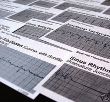 Amazon.com : EKG ECG Cardiac Acls Rhythm Strip Flashcards : Other ...