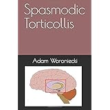 Spasmodic Torticollis Handbook: A Guide to Treatment and Rehabilitation ...