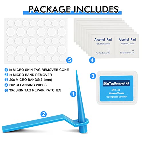 Micro Skin Tag Remover Kit - Painless Skin Tag Removal Tag Away Skin ...