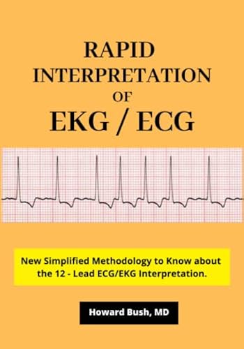 RAPID INTERPRETATION OF EKG/ECG: New Simplified Methodology to Know ...