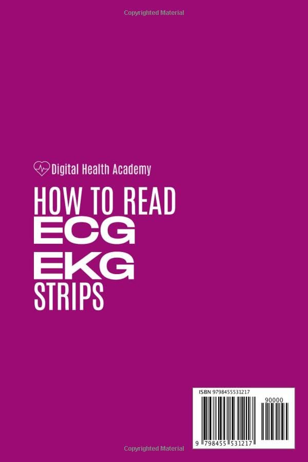 How to Read EKG/ECG Strips: A Step-By-Step Guide for Students to ...