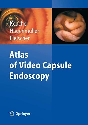 Atlas of Video Capsule Endoscopy: 9783540231288: Medicine & Health ...