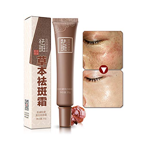 MQ Skin Brightening Cream, Freckle Cream for Face & Melasma Treatment ...