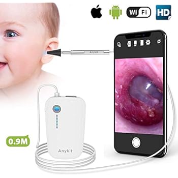 Amazon.com : Ear Camera, 1080P FHD Wireless Ear Scope, Super Light Lens ...