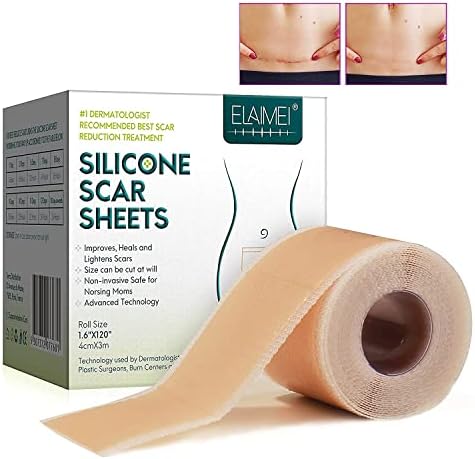 Scar Away Silicone Scar Sheets (1.6” x 120”), Silicone Scar Tape Roll ...