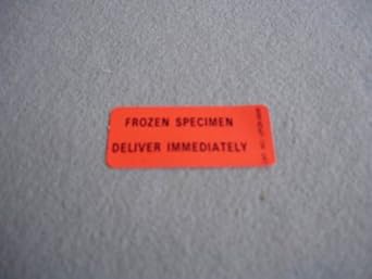 Amazon.com: Label, 'Frozen Specimen/Immediate Delivery(1''x2.25'') (500 ...