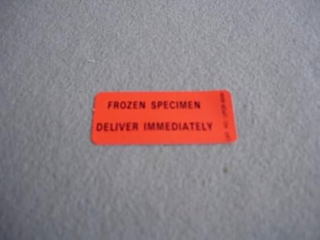 Amazon.com: Label, 'Frozen Specimen/Immediate Delivery(1''x2.25'') (500 ...