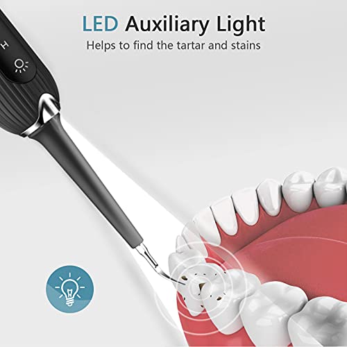 Electric Plaque Remover for Teeth, TinyNN Professional Teeth Cleaning ...
