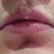 Compeed Invisible Cold Sore Patch, 15 patches: Amazon.co.uk: Health ...