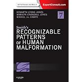 Smith's Recognizable Patterns of Human Malformation: Expert Consult ...