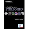 A Practical Approach to Stereo EEG: 9780826136923: Medicine & Health ...