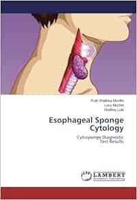 Esophageal Sponge Cytology: Cytosponge Diagnostic Test Results ...