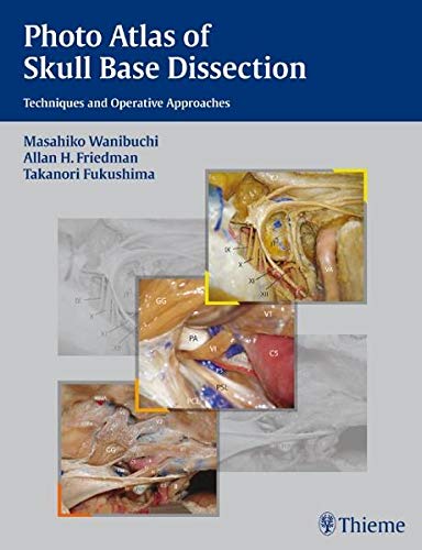 Photo Atlas of Skull Base Dissection: Techniques and Operative ...