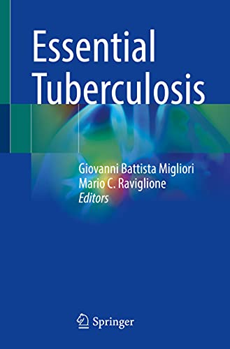 Essential Tuberculosis: 9783030667054: Medicine & Health Science Books ...