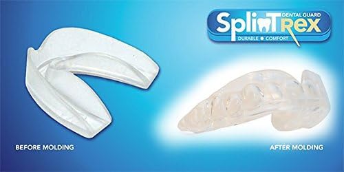 Sparkling White Smiles Professional Teeth Mouth Guards for Teeth ...