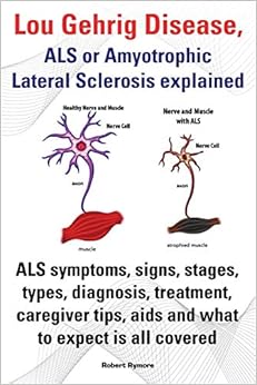 Lou Gehrig Disease, ALS or Amyotrophic Lateral Sclerosis Explained. ALS ...