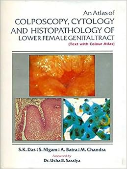 An Atlas of Colposcopy, Cytology & Histopathology of Lower Female ...