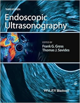 Endoscopic Ultrasonography: 9781118781104: Medicine & Health Science ...
