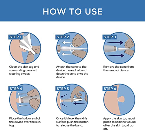 Skin Tag Remover, Skin Tag Removal Kit, Auto Tag Remover Tools, Remove ...