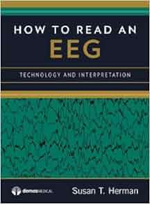 How to Read an Eeg: Technology and Interpretation: 9781936287246 ...