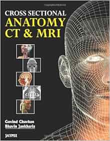 Cross Sectional Anatomy CT & MRI: 8601415720037: Medicine & Health ...