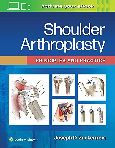Shoulder Arthroplasty: Principles and Practice: 9781975157661: Medicine ...