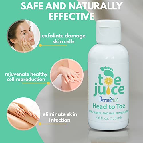 Toe Juice with DermaVine All-Natural Head to Toe Itchy Skin Relief ...