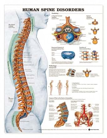 Amazon.com: The Human Spine - Disorders: Industrial & Scientific