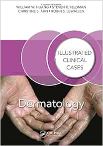 Dermatology: Illustrated Clinical Cases: 9781498722889: Medicine & Health Science Books @ Amazon.com