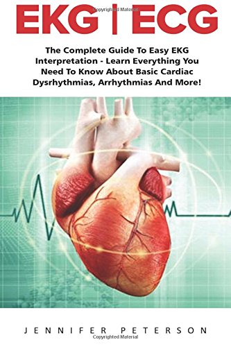 Ekg Ecg The Complete Guide To Easy Ekg Interpretation Learn ...