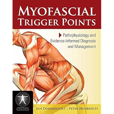 Myofascial Trigger Points: Evidence-Informed Philippines | Ubuy