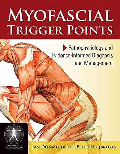 Myofascial Trigger Points: Pathophysiology and Evidence-Informed ...